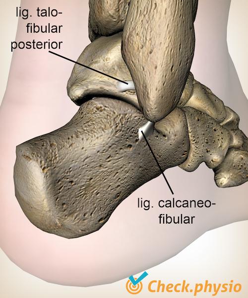 Esguince de ligamento lateral de tobillo